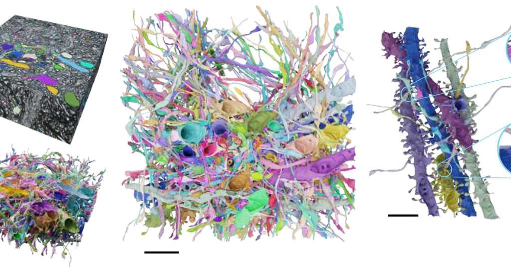 Blown up brain cells’ connections and chemistry traced at incredible ...