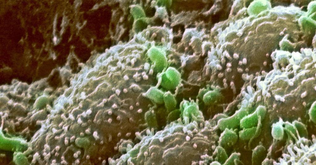 Explainer: The chemistry of farts | News | Chemistry World