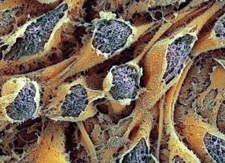 Cells with potential | Feature | Chemistry World