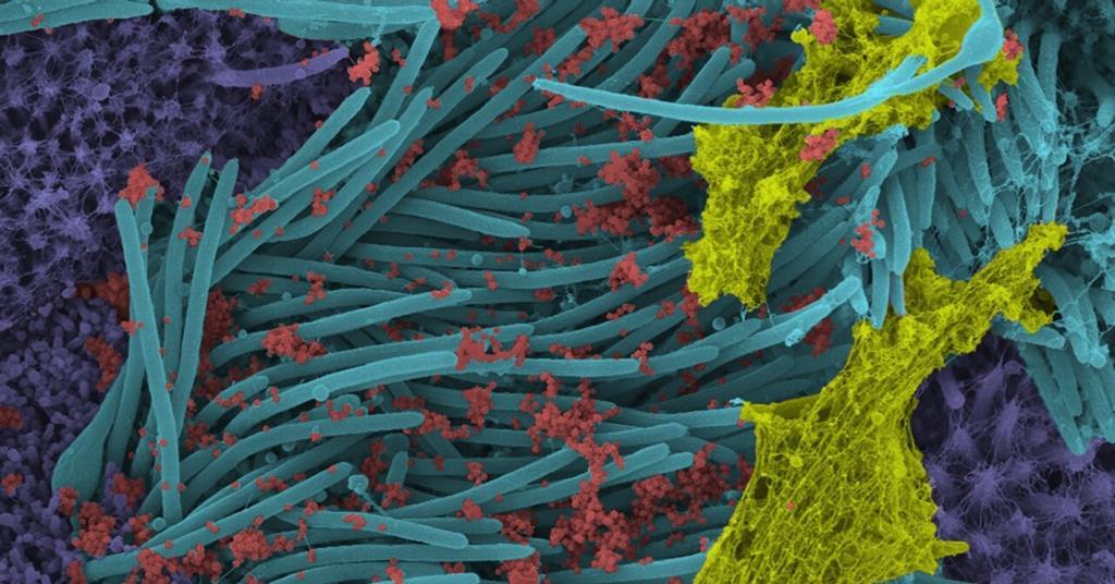 Structure, lifecycle and replication machinery of SARS-CoV-2 | Book ...