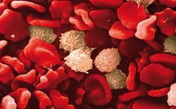 Stemming the tide | Feature | Chemistry World