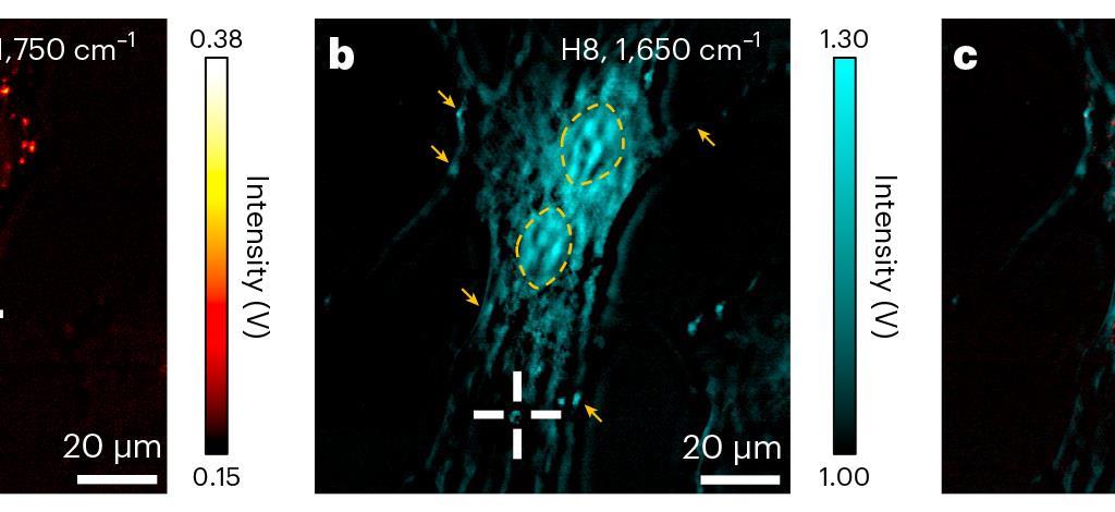 Super-resolution microscopy ditches fluorescent tags for gentler ...