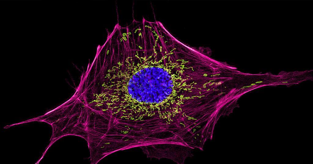 Super Resolution Microscopy Ditches Fluorescent Tags For Gentler Imaging Of Live Cells