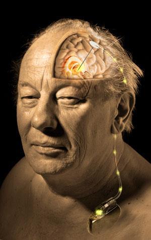 Tracking chemical changes in the brain | Research | Chemistry World