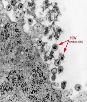 New HIV blocker prepares for market | News | Chemistry World