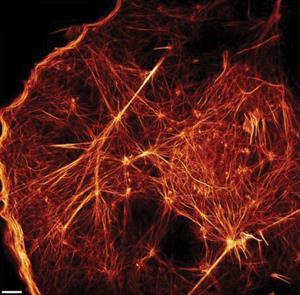 Nanoscale microscopy casts light on cellular dynamics | Research ...