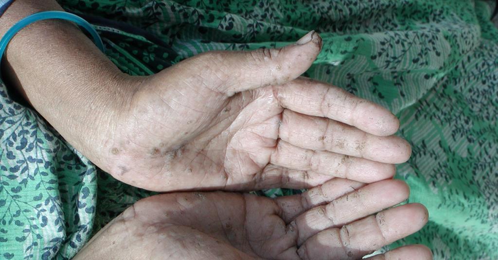 Arsenic and rice - a growing problem? | Feature | Chemistry World