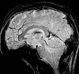 I spy with my MRI | Feature | Chemistry World