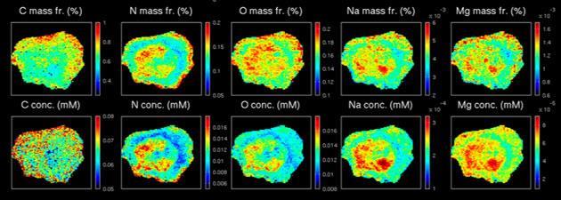 Elemental discoveries at the cellular level | Research | Chemistry World