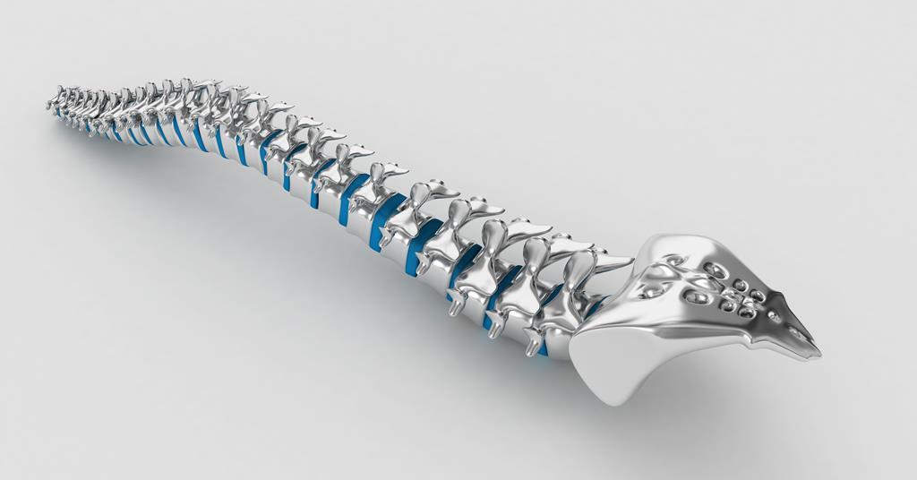 Polymer shows some backbone as it becomes first with extended metal ...