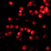 Hydrogen peroxide probe | News | Chemistry World