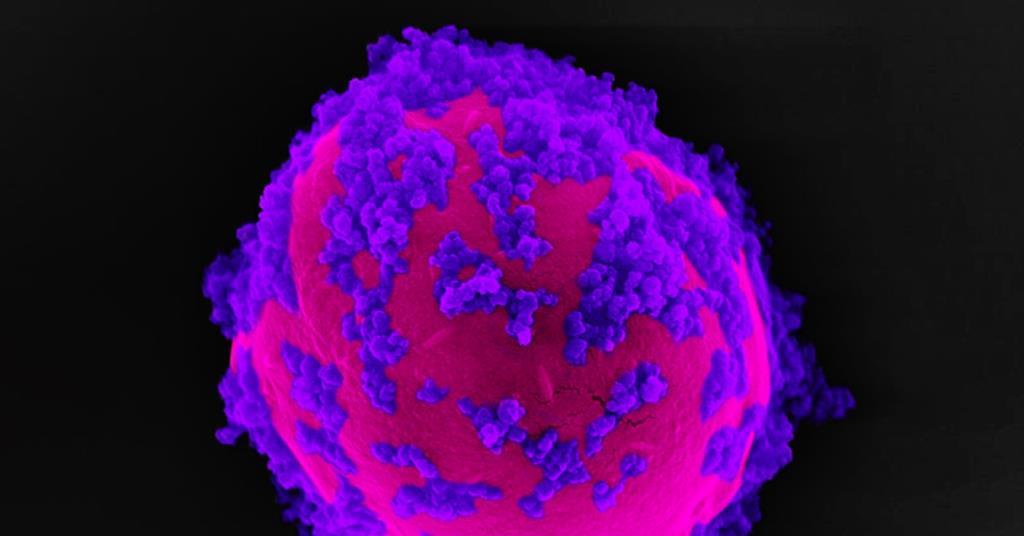 Drug precursor made by solar-powered cyborg yeast | Research ...