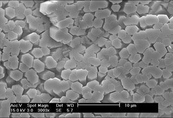 Chemical fix for a perfect smile | News | Chemistry World