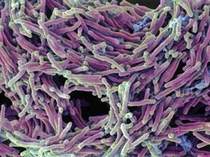 Antibiotic partnership plans accelerated drug development | News ...