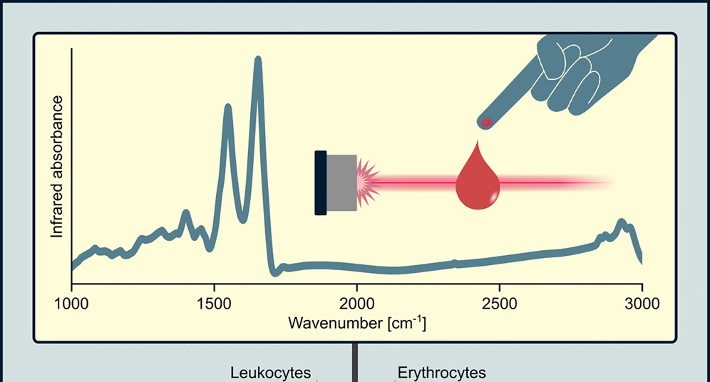 Analytical chemistry tools point to the future of personalised medical ...