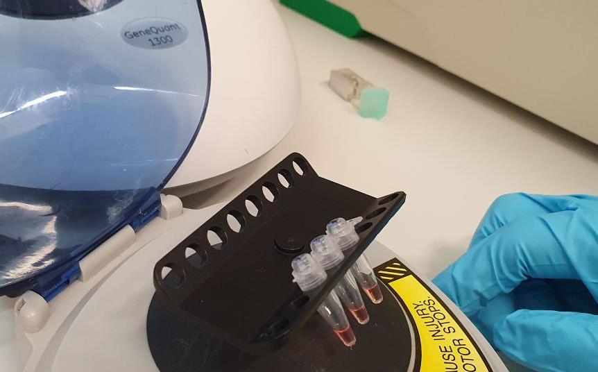 New Covid-19 test delivers diagnoses up to three time faster | News ...