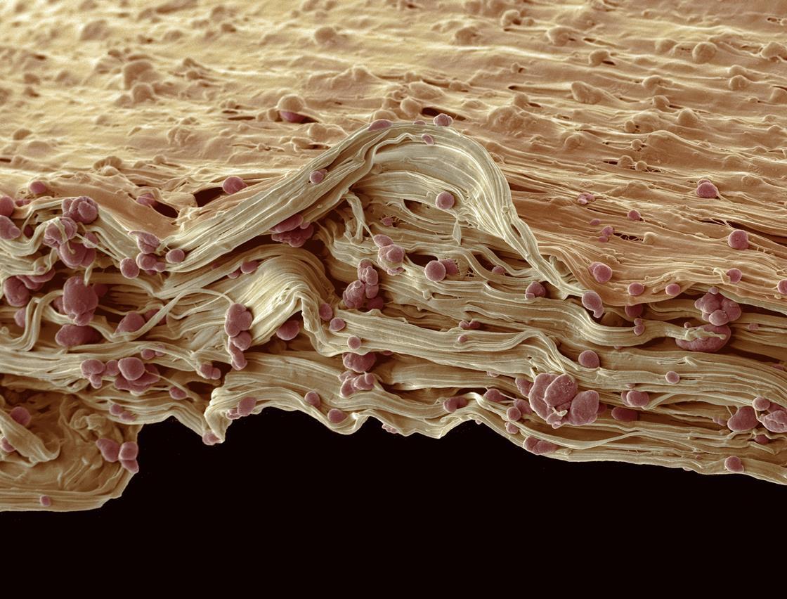 Addressing the plastics problem | Opinion | Chemistry World