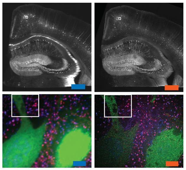 Blowing up brain tissue with swelling polymer delivers sharper images ...