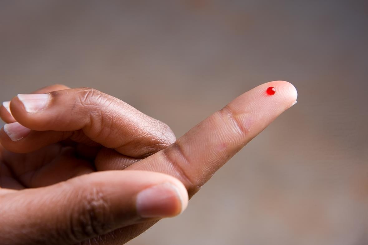 Blood biopsies for cancer | Feature | Chemistry World