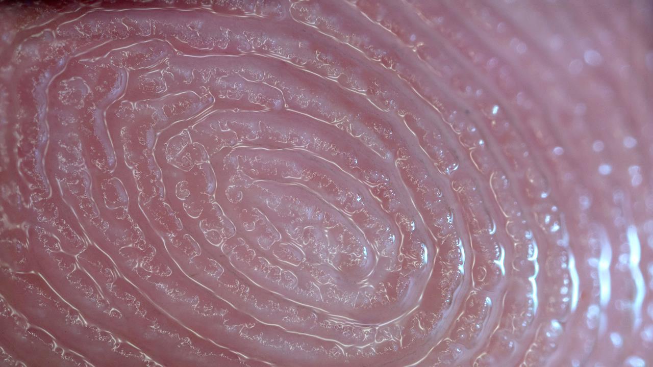 Finger sweat test shows promise for checking that patients are taking ...