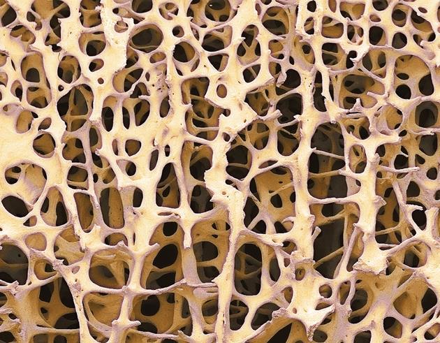 Building better bones | Feature | Chemistry World