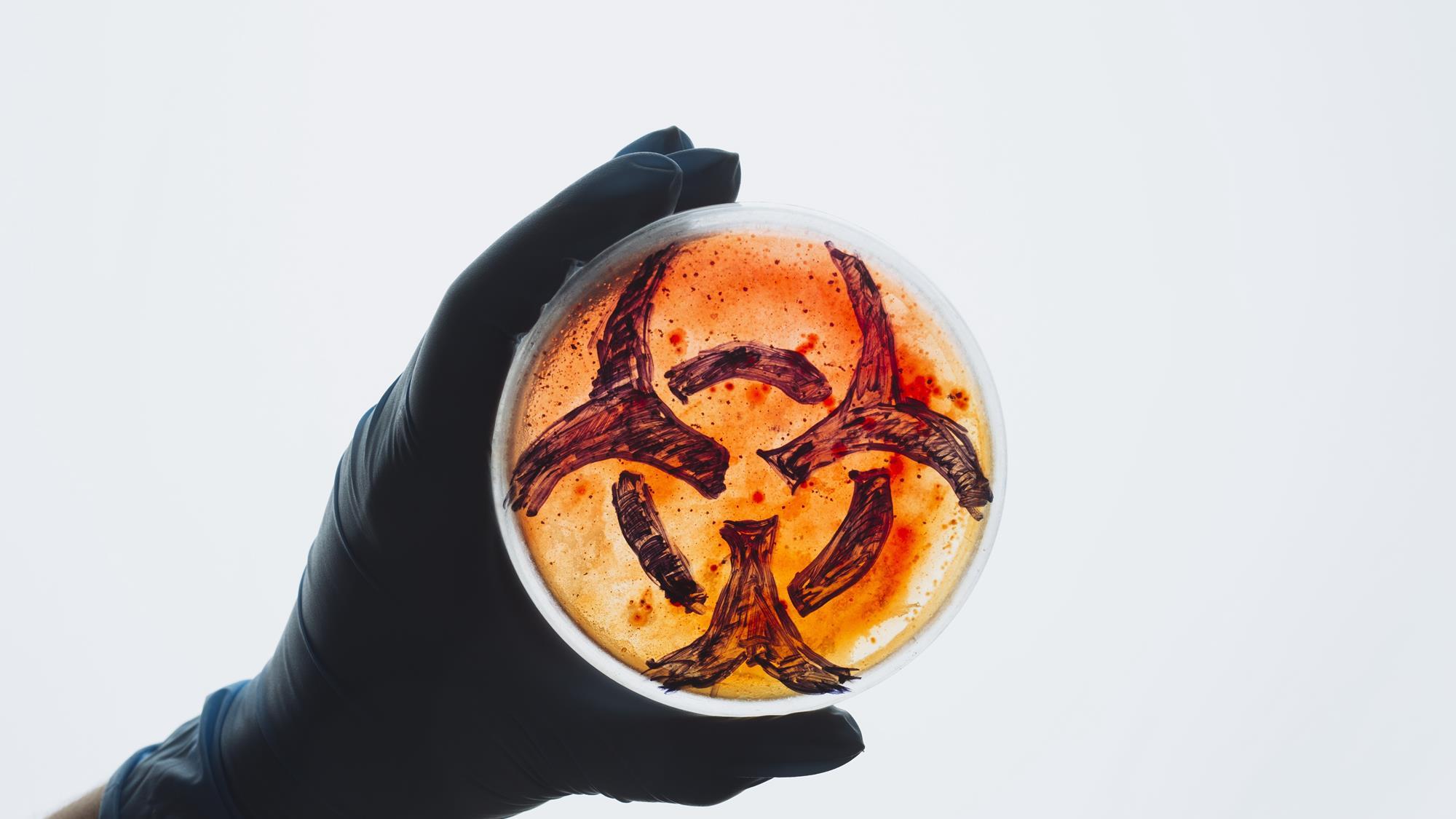 NIH resumes funding for research to create more dangerous pathogens ...