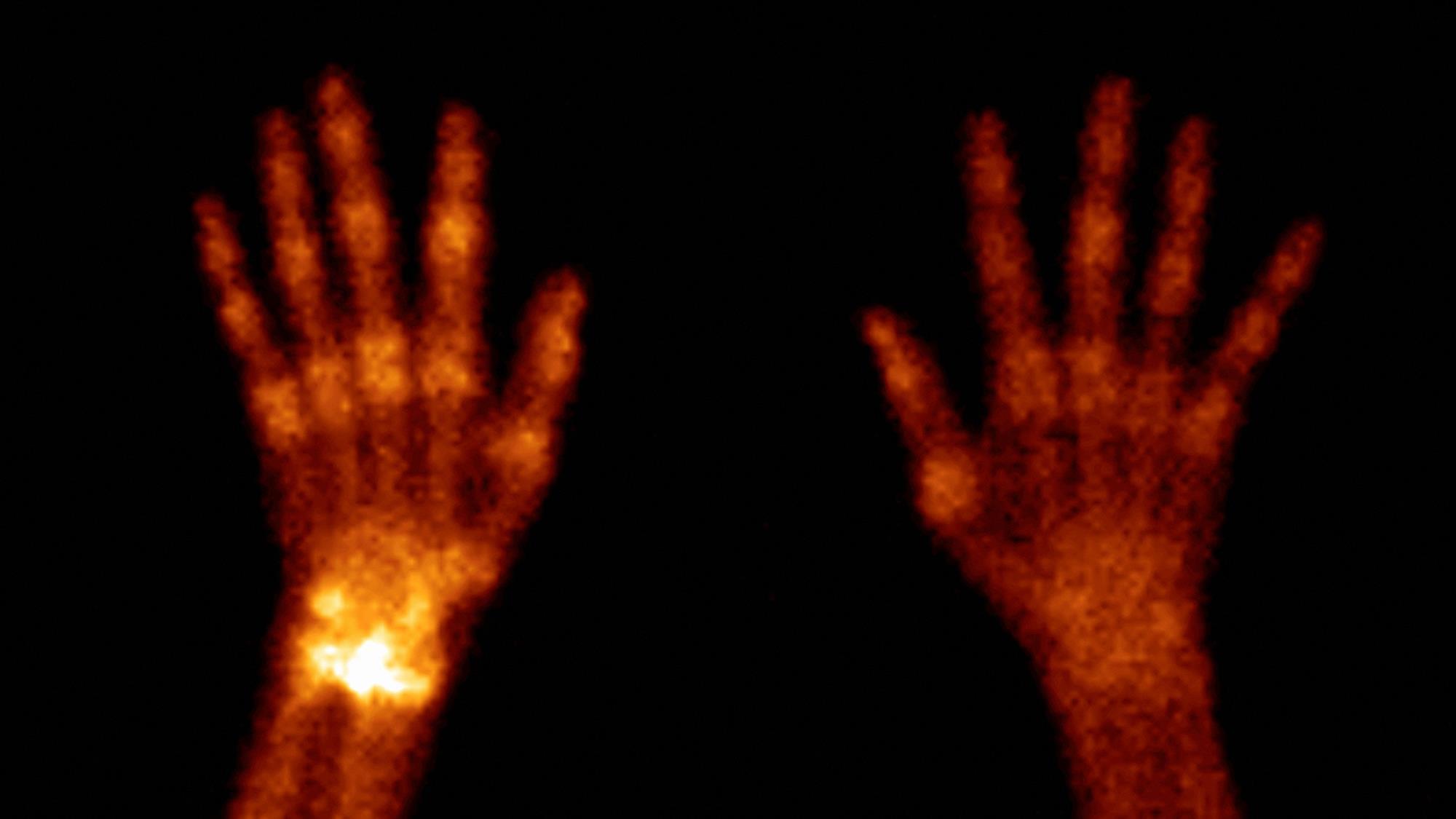 FDA approves new way to make medical imaging isotope | News | Chemistry ...