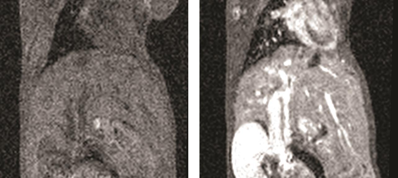 New MRI contrast agents | Feature | Chemistry World