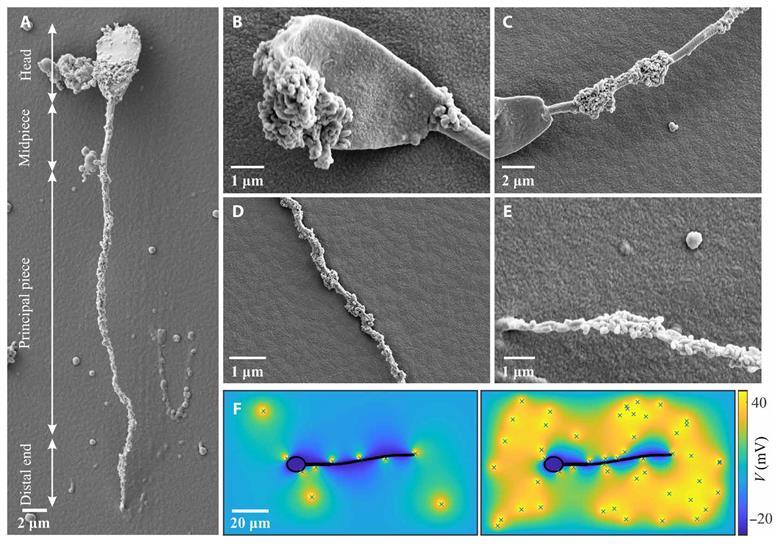 Suit of iron turns sperm cells into spermbots | News | Chemistry World