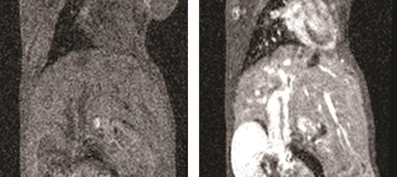 New MRI contrast agents | Feature | Chemistry World