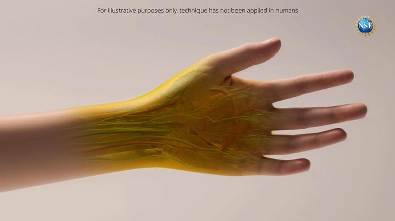 Yellow food dye could give doctors a new way to look beneath the skin ...