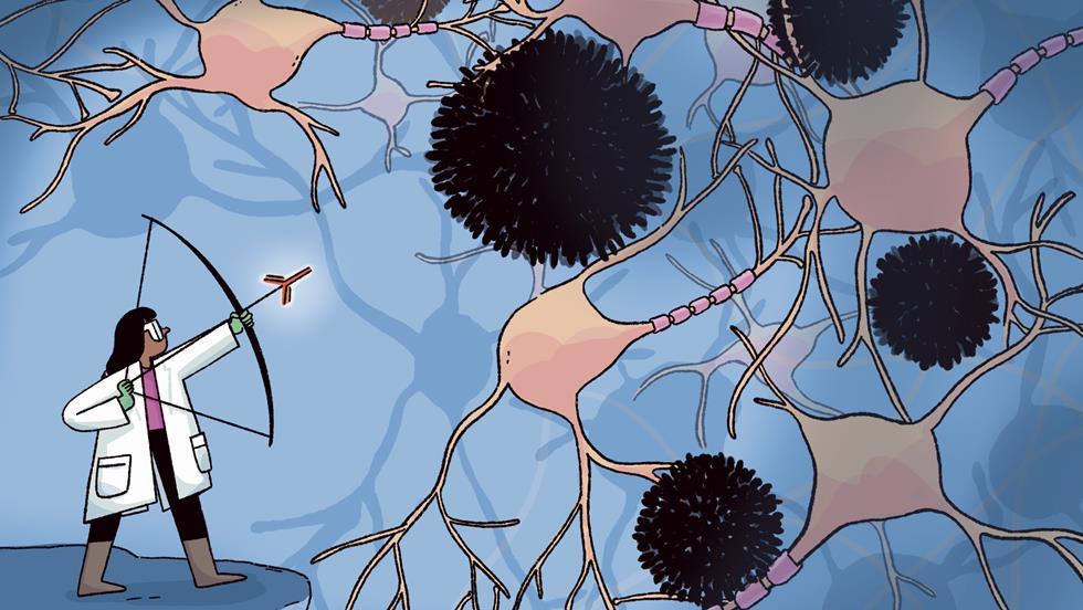 Brain chemistry basics | Feature | Chemistry World